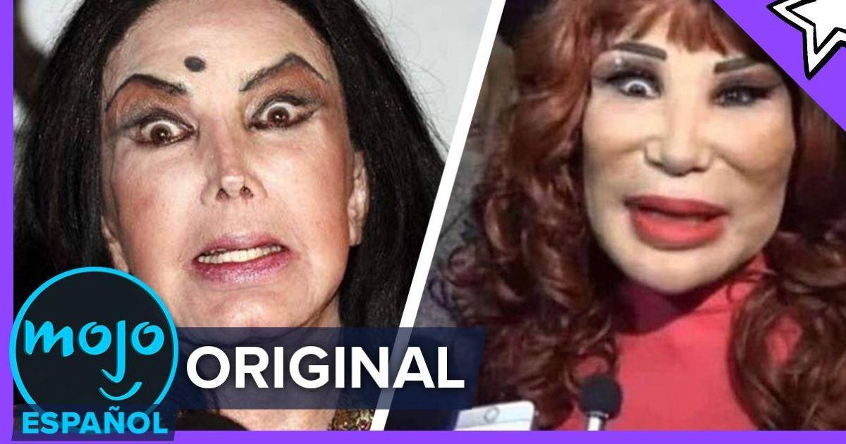 Celebridades Antes Y Después De La Cirugía Plástica Que Salió Mal